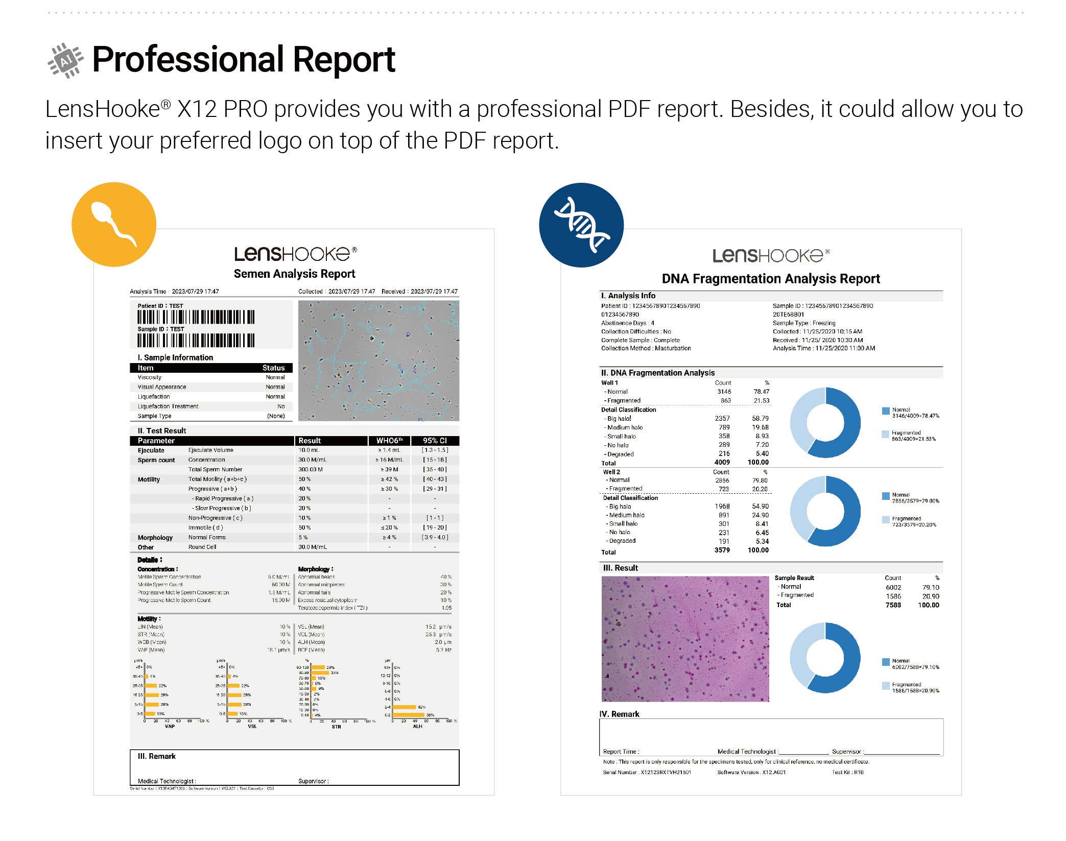 LensHooke X12 PRO Semen Analysis System - LensHooke